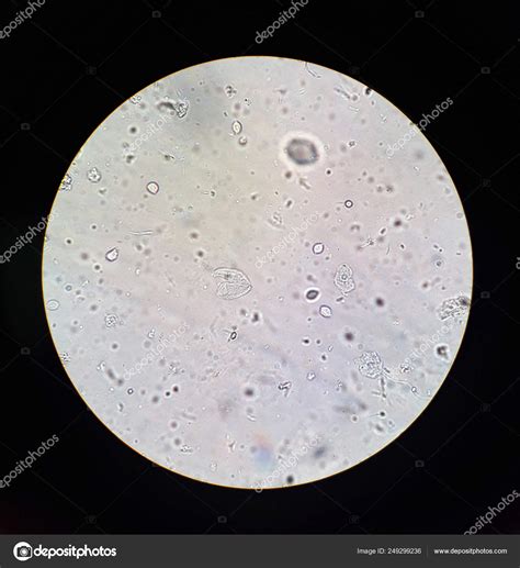 Trichomonas In Urine Sediment