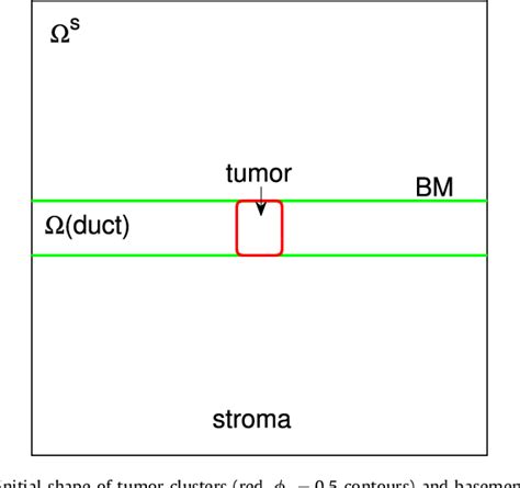 Figure 1 From Tumor Growth And Calcification In Evolving
