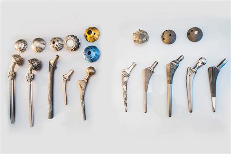 Indian Government To Explore Biodegradable Orthopedic Implants