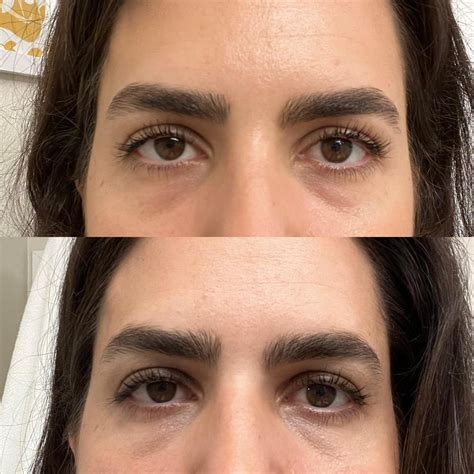 I Did Threading Reyebrows