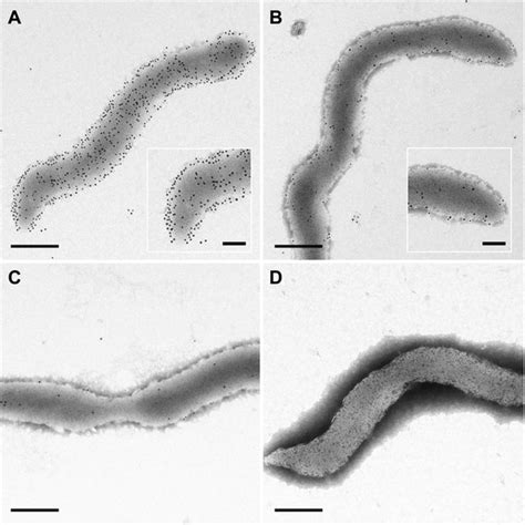 Immunogold Labelling Transmission Electron Microscopy Of S Citri
