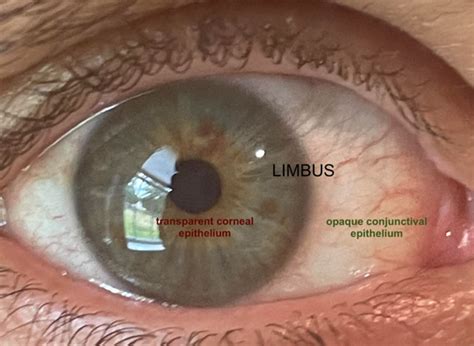 Limbus Eye Anatomy A The Anatomy Of The Eye Cornea B The Cornea