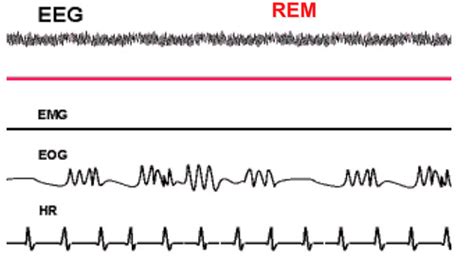 Neuro Phys 4 Flashcards Quizlet