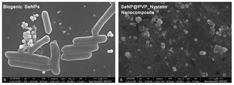 Antifungal Properties Of Biogenic Selenium Nanoparticles Functionalized With Nystatin For The