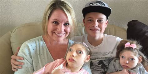 My Daughters Were Born With Microcephaly Zika Virus And Pregnancy