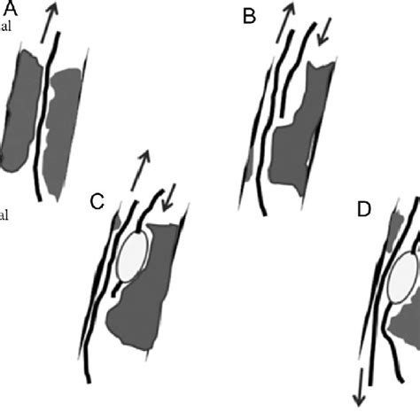 Parallel Wire Technique Download Scientific Diagram