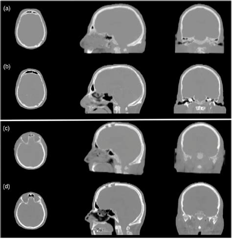 Visual Comparison Between Pct A And C And Ct B And D For Two Download Scientific Diagram