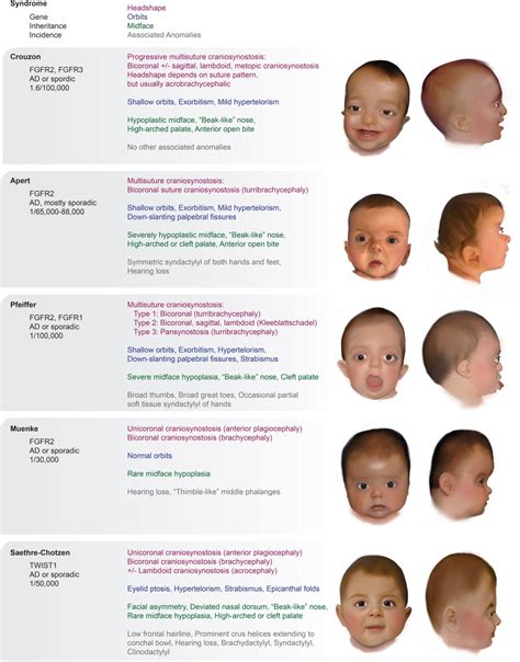 Craniosynostosis Plastic Surgery Key