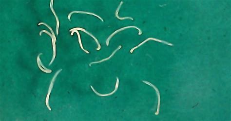 Asthma And Allergies May Find An Unlikely Treatment In Hookworm Saliva