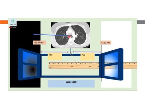 Understanding Ct Scan Windowing Pptx