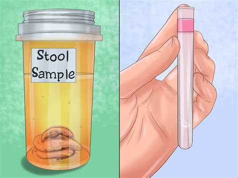 How To Treat Amebiasis 13 Steps With Pictures Wikihow