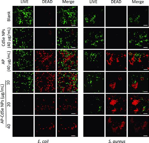 Confocal Fluorescence Microscopy Assay Mdr E Coli And Mdr S Aureus
