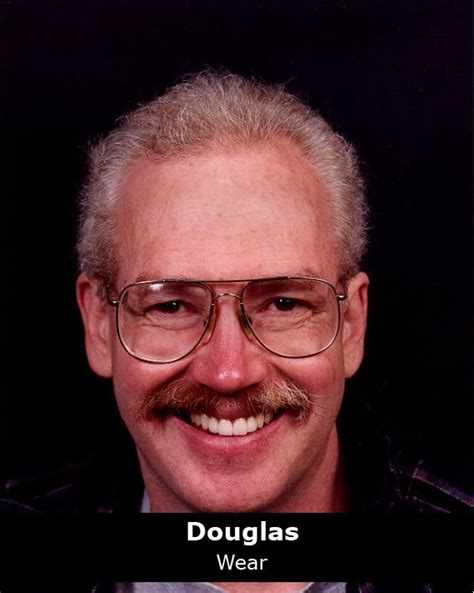 Worn Teeth Gallery Teeth Transformations By Amy Norman Dds