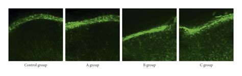 Gfap Immunofluorescence Staining In Stn Nerve In Rats After Rs