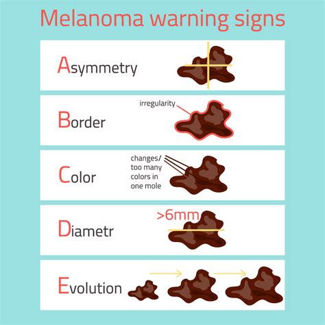 Melanoma
