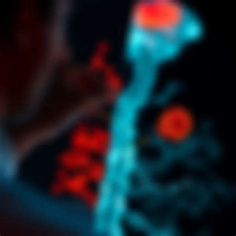 Early Stage Leukemia Cutis Insights And Images