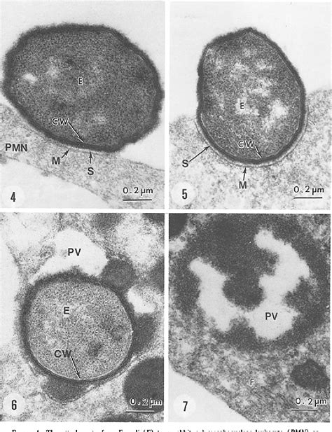 Phagocytosis Microscope