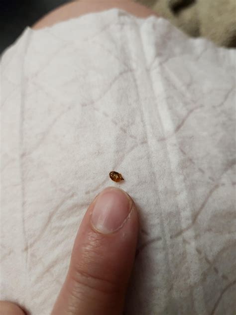 Bed Bug Abdomen Ohio Rwhatsthisbug