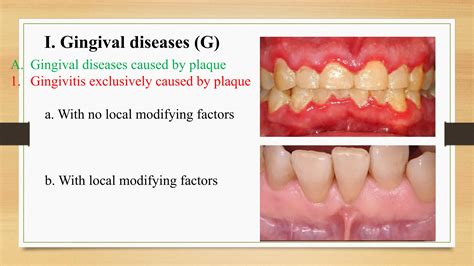 Periodontal Diseases Classificationpptx
