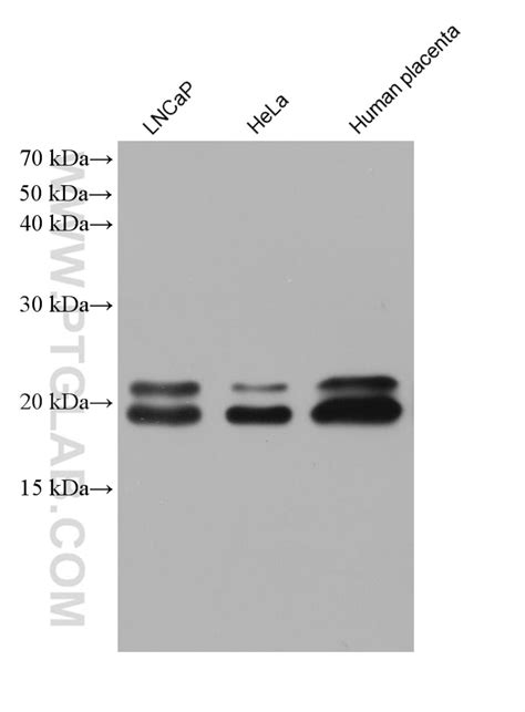Arl8a Arl8b Antibody 68186 1 Ig Proteintech
