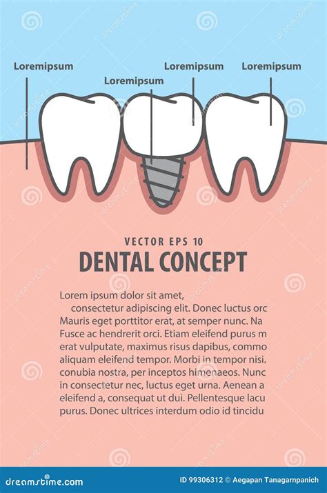 The Layout Of The Teeth Vector Drawing 165996805