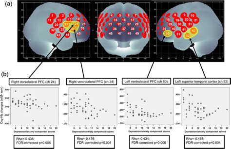 Cortical Distribution Of The Areas Of Significant Correlation Between
