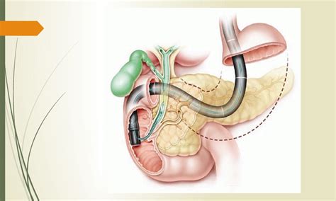 Ercp Nedir Prof Dr Cengiz Pata