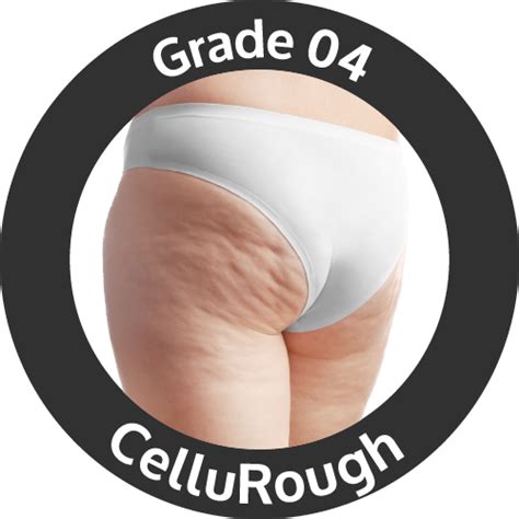Cellulite Factor Ecl 5th And Glow™