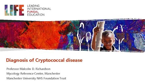 Diagnosis Of Cryptococcal Disease Professor Malcolm D Richardson