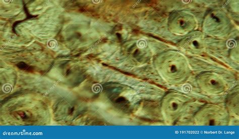 Cross Section Of Decalcified Bone Stock Footage Video Of Medic Check