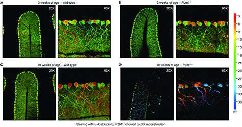 expected outcome of purkinje cell imaging in 3d reconstruction with