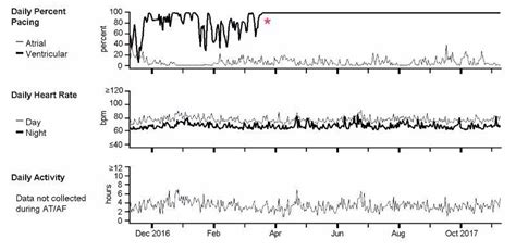 Whats The Difference Between Syncope And Sudden Death In 112016 An