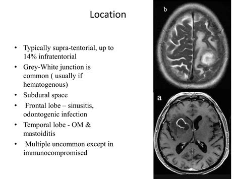 Imaging In Cns Infections Pptx
