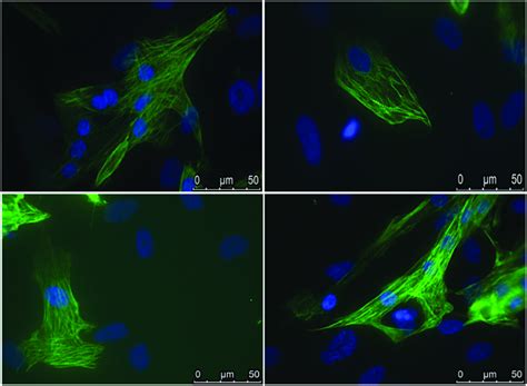 Immunostaining Of Ctnt In Green In Hipsc Derived Cardiomyocytes