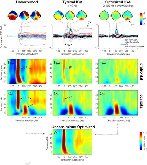 Figure 3 From Optimizing The Ica Based Removal Of Ocular Eeg Artifacts