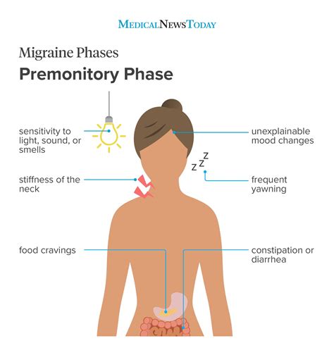 How To Diagnose Migraine Possibilityobligation5