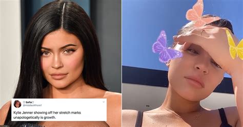 Kylie Jenner Shows Off Her Stretch Marks On Instagram Popsugar Beauty