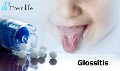 Glossitis Premilife Homeopathic Remedies