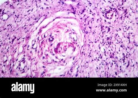 Nerve Tissue Micrograph Stock Videos And Footage Hd And 4k Video Clips