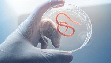 Are You At Risk For Parasites Alive Fit