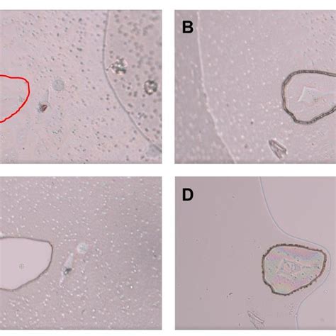 Workflow Isolating A Single Living Cell A A Single Cell Is Marked B Download Scientific