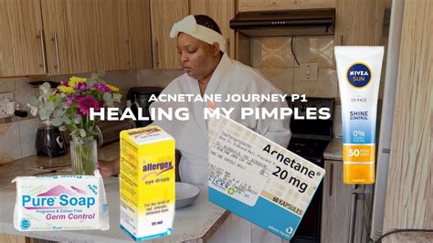 Acnetane Journeyp1 How Im Currently Treating My Pimples Youtube