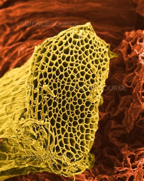 Collenchyma Cells In Celery