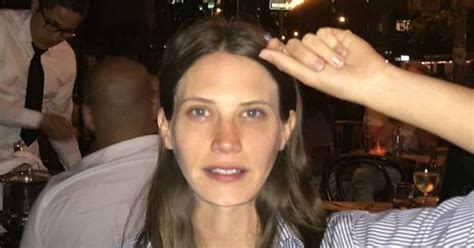 Jaw Shaving Temporal Implants Album On Imgur