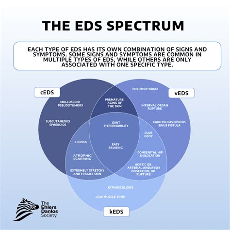 What Is Eds The Ehlers Danlos Society
