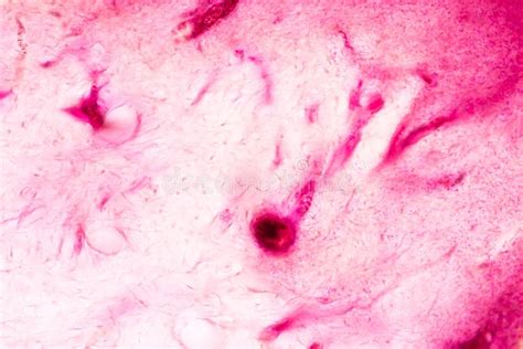 Tooth Development From Human Under Microscope Stock Image Image Of