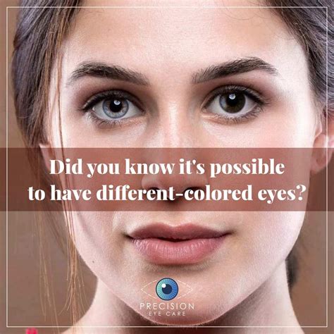 Did You Know Its Possible To Have Different Colored Eyes Precision Eye Care Comprehensive