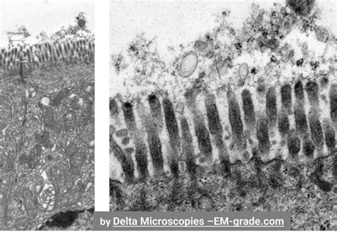 Glutaraldéhyde 2 Bleu Alcian Dans Un Tampon 01m Em Grade