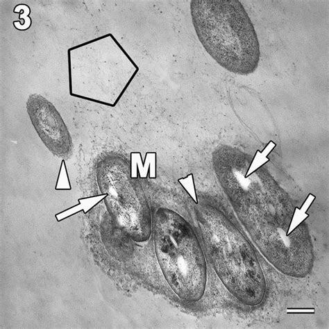 Tem Of Mitochondria Cells For Control And Treated Þsh Control Þsh With
