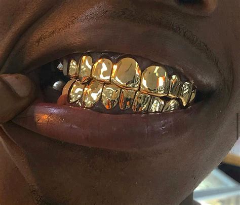 Special Custom Solid Gold Grillz · Cali Jewelers